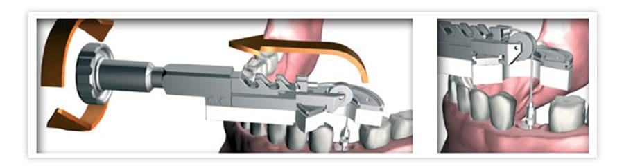 Our Technology - Orthosmiledental Clinic Dentist Pattaya